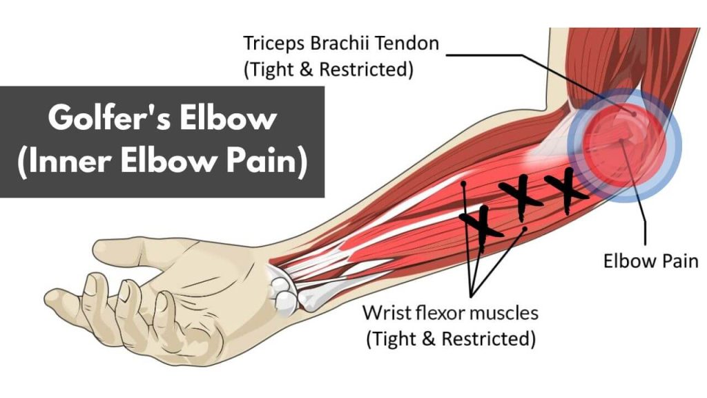HAND & WRIST INJURIES – HAQ Orthopaedic